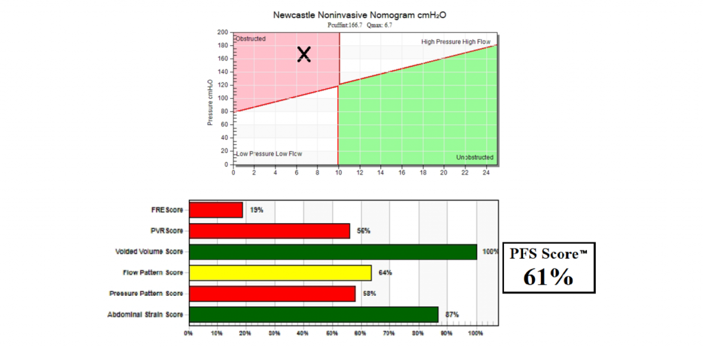 SRS Medical – Simple Revolutionary Solutions for male LUTS/BPH patients
