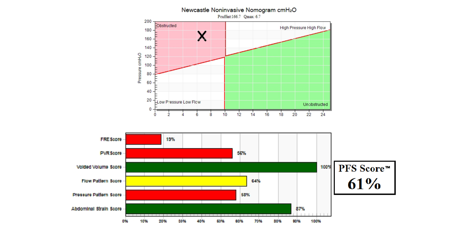 SRS Medical – Simple Revolutionary Solutions for male LUTS/BPH patients