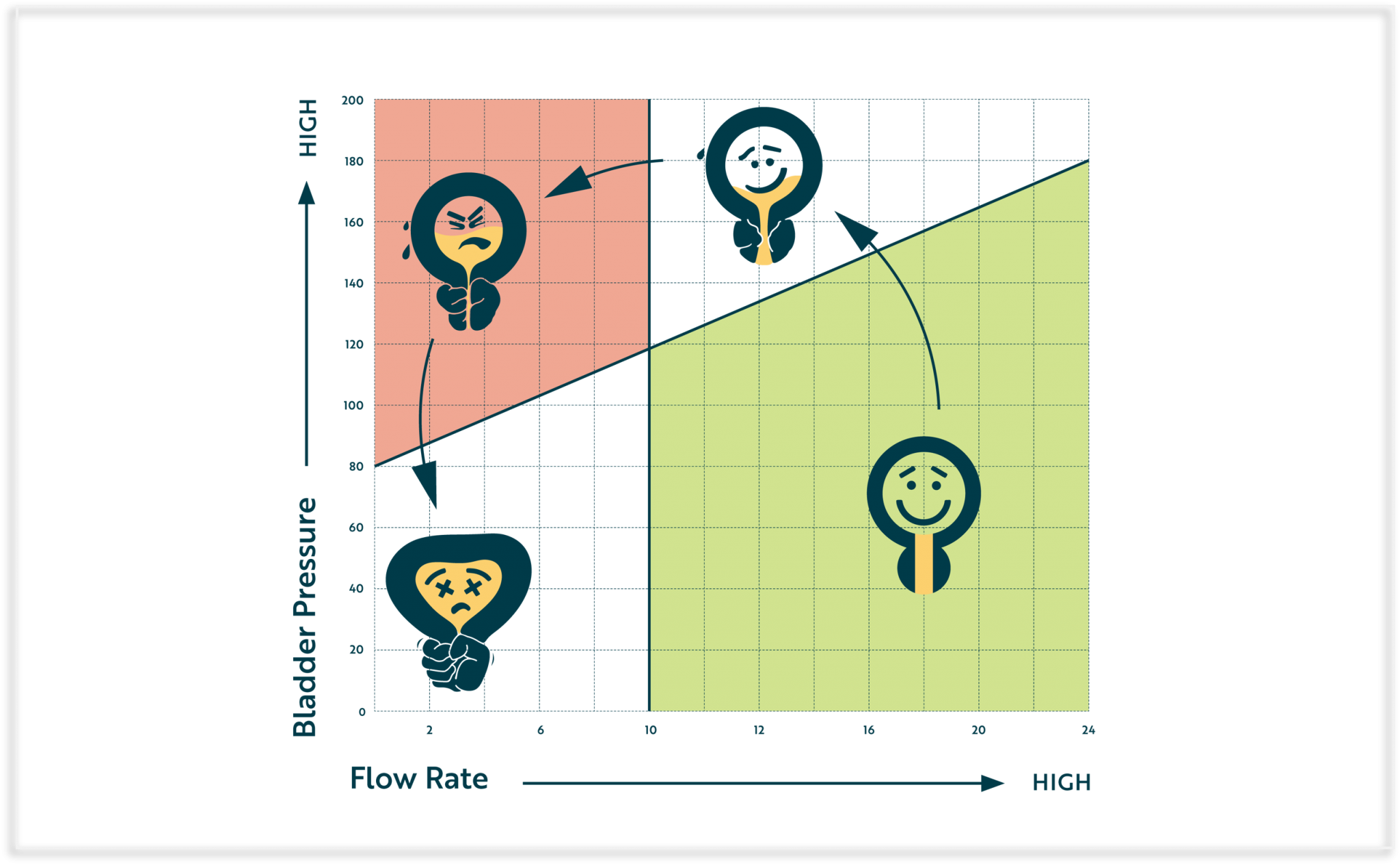 SRS Medical – Simple Revolutionary Solutions for male LUTS/BPH patients