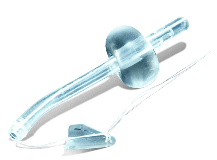 SRS Medical | The Spanner® Stent | Patient Information